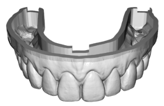 The Tools you need for Retainer Manufacturing - Dental Axess